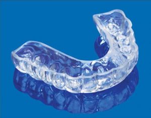 Plaque occlusale | Dentiste Knight